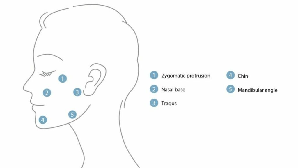 Face-Lifting Injectable Active Polynucleotides | Become Aesthetics Clinic
