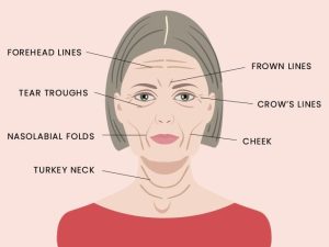 Is Your Sleep Causing You Wrinkles? Sleep Wrinkles Explained