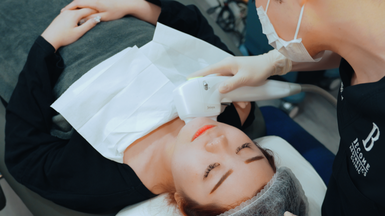 Achieving a V-Shaped Face with HIFU Treatment