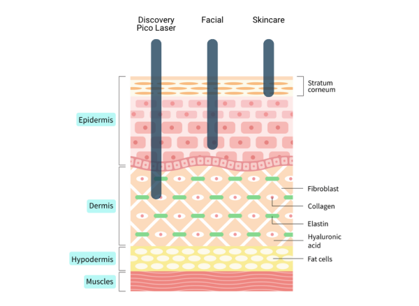 Pico Laser Singapore (+ Anti-Pigment Ampoule) | $48 Nett