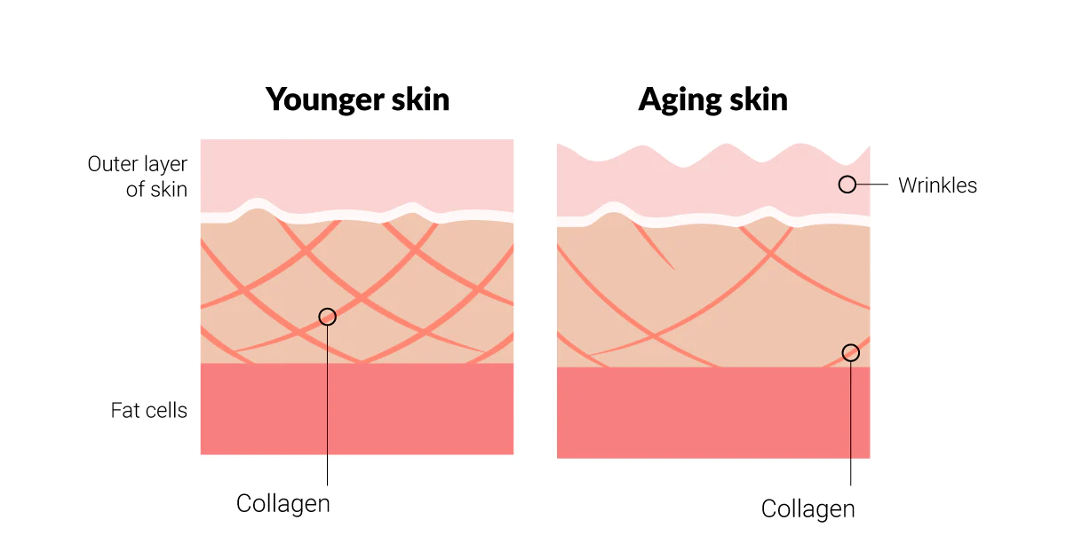 Collagen's Vital Role and How HIFU Treatment Boosts It