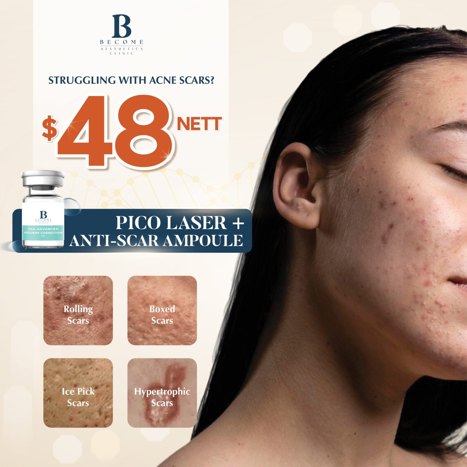 Acne Scar Treatment Singapore | Become Aesthetics Clinic Singapore